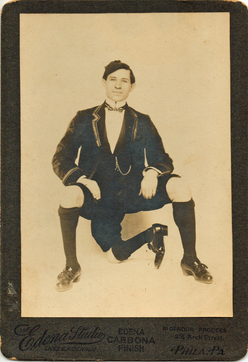 Portrait of Francisco Lentini, The three legged man