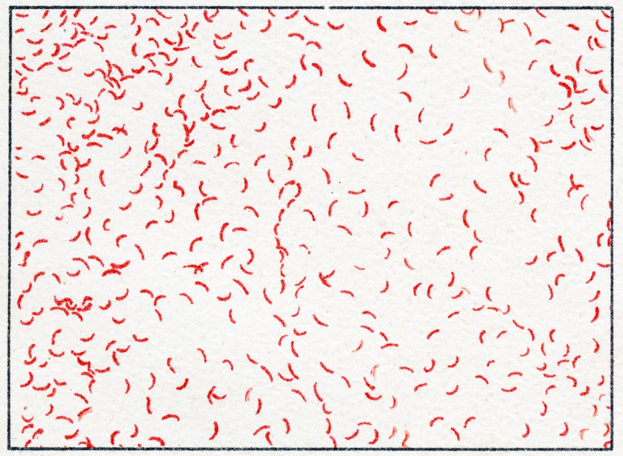 Vibrio Bacteria Shape Under Microscope