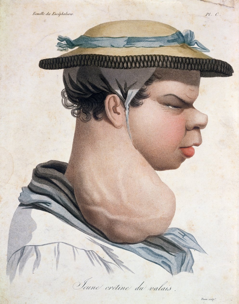 Cretin - Nghĩa, Cách Sử Dụng, Từ Đồng Nghĩa và Bài Tập Ngữ Pháp